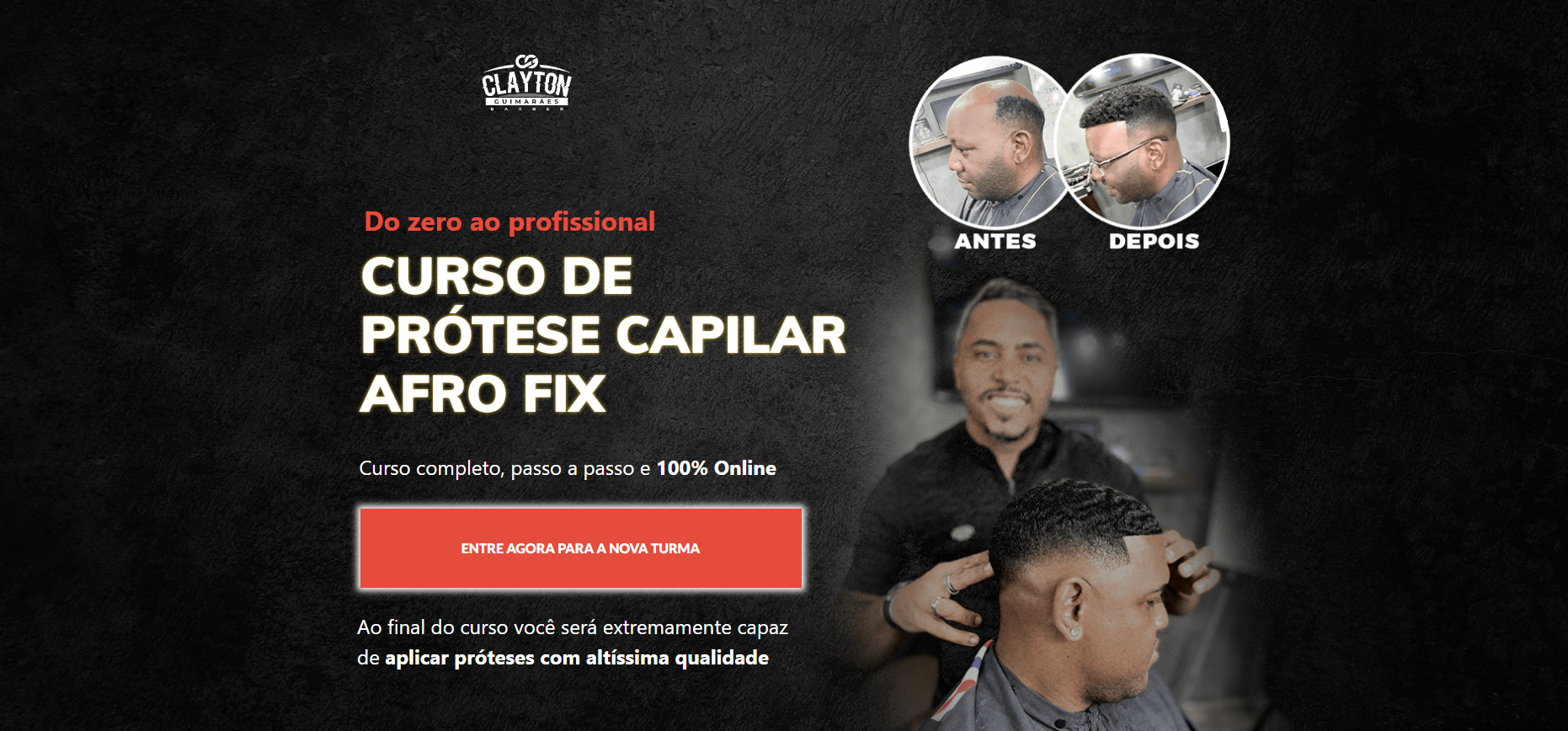 Clayton Guimarães | Prótese Capilar Afro Fix